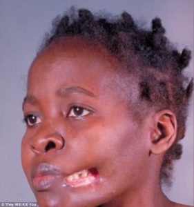 10 of the Scariest Diseases Known to Affect Humans – Elite Readers