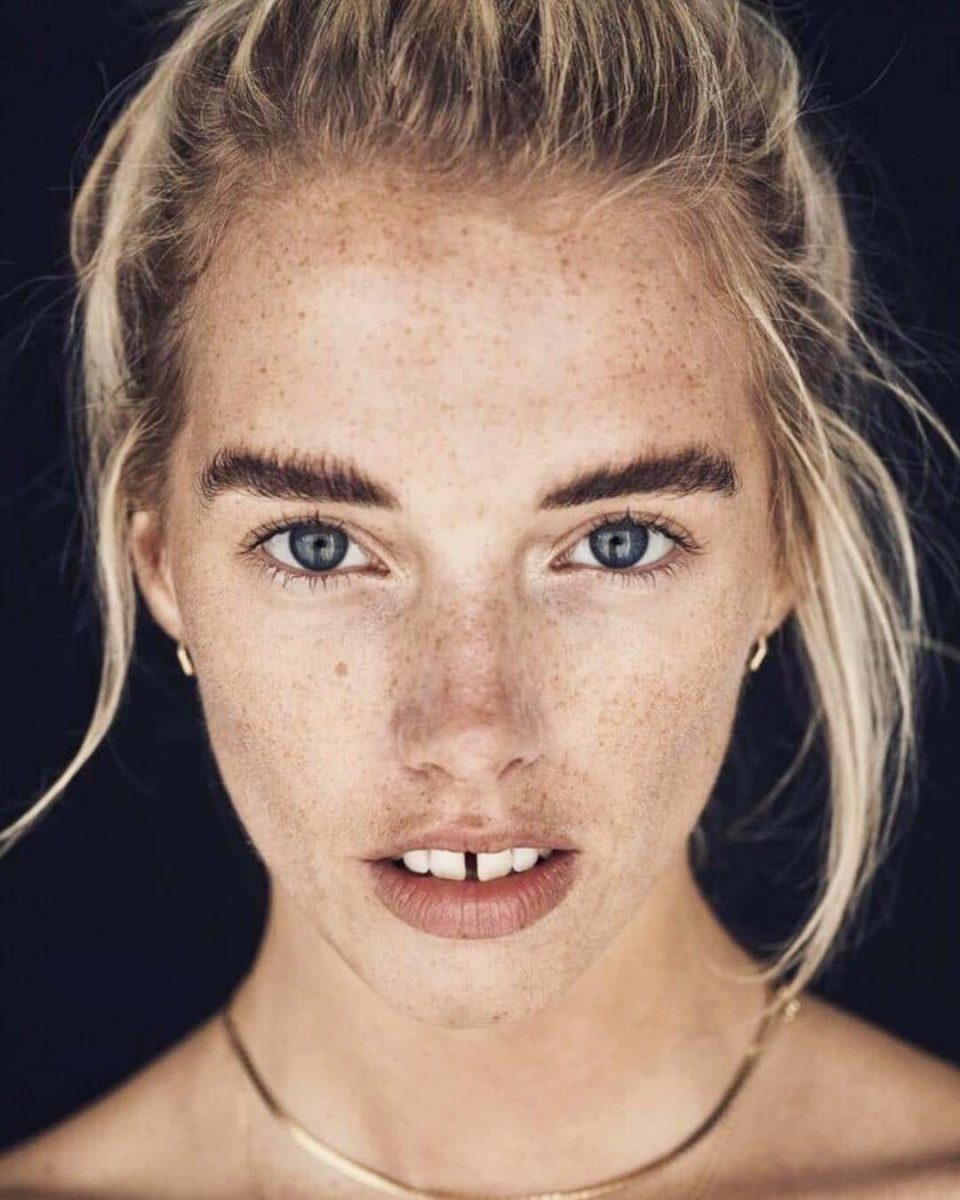 10 Unique-Looking Models Who Are Changing The Face Of Beauty – Elite ...